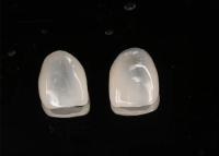 China Aesthetic Restoration Emax Ceramic Veneers Translucency with Polished Surface for sale
