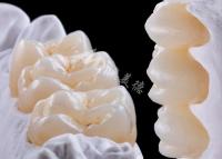 China High Strength Zirconia Dental Crown For Single Or Multiple Teeth Replacement for sale