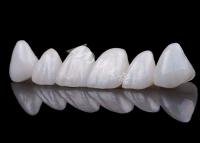 China Natural Looking Zirconia Tooth Crown Stain Resistance All Zirconia Crown for sale