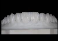 China Translucency Natural Esthetic Zirconia Crowns Excellent Biocompatibility And Strength for sale