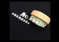 China Transform Your Smile with IPS emax Press Porcelain Veneers Strength Aesthetics and Durability Combined for sale