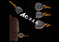 China Strength EMAX Veneer Natural Appearance Excellent Fit for Esthetic Restorations for sale