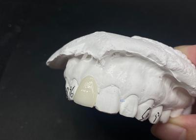 China Translucent Custom Dental Veneers Fast and Effective Solutions for Long-Lasting Smile for sale