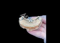 China MSE Palatal Expander Innovative Orthodontic Appliances For Effective Teeth Alignment for sale