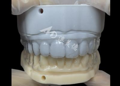 China Orthodontic retainer　Essix Retainer Simple And Versatile Correction for sale
