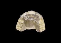 China Inclined Plane Guide for Precision in Tooth Movement and Occlusion for sale