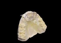 China Inclined Plane Guide for Precision in Tooth Movement and Occlusion for sale