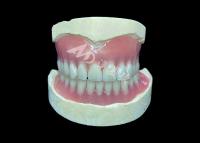 China Easy-to-Clean Custom Cast Partial Dentures Ideal for Restoring Chewing Ability and Smiles for sale