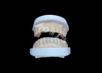 China IPS Emax Veneers Natural Looking Restorations For Esthetic Smiles for sale