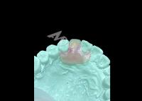 China Lightweight Comfortable Nesbit Flexible Denture for Single Tooth Replacement for sale