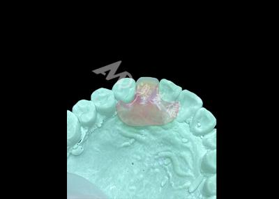 China Lightweight Comfortable Nesbit Flexible Denture for Single Tooth Replacement for sale