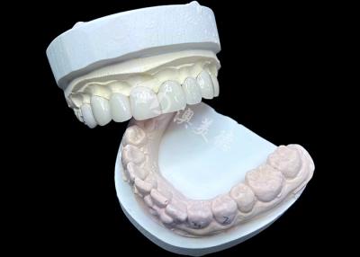 China IPS e.max Veneers in Shade BL2 Achieve Stunning Natural Aesthetics for sale