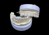 China Customization Ultra Thin Glass Ceramic Veneers High Translucency for sale