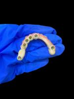 China Titanium Abutment and Zirconia Crown Implant Supported Dentures Precision Fit for Comfortable Wear for sale