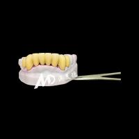 China Durable Zirconia Dental Crown with Metal Post Core for Strong, Natural-Looking Tooth Restoration for sale