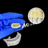 China PMMA Provisional Implant Bridge with Hollow Inside for Stability and Natural Healing, High-precision CAD/CAM Fabrication, Biocompatible PMMA Material for sale