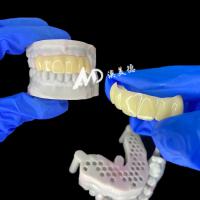 China PMMA Provisional Implant Bridge with Hollow Inside for Stability and Natural Healing, High-precision CAD/CAM Fabrication, Biocompatible PMMA Material for sale