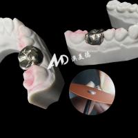 China Metal Titanium Crown Precision Strength and Biocompatibility for Lasting Restorations for sale