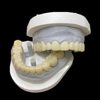 China PMMA Temporary Restorations CAD/CAM PMMA Crowns and Bridges for Provisional Dental Cases for sale