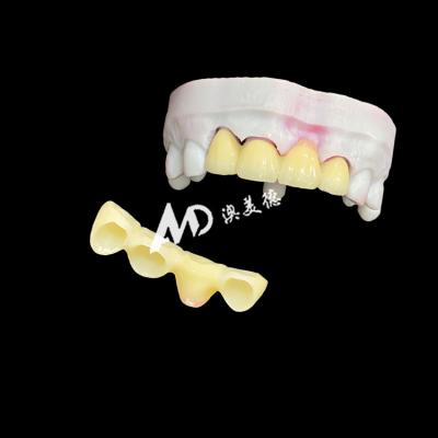 China Premium Ceramic Crowns and Bridges for High-Strength, Natural Aesthetics and Long-Lasting Clinical Performance for sale