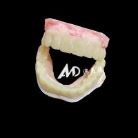 China Lightweight PMMA Temporary Bridges with Hollow Design for Implant Restorations for sale