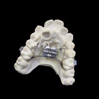 China Achieve Precise Arch Expansion with Our Orthodontic Expander with Molar Bands for sale