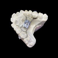 China Achieve Precise Arch Expansion with Our Orthodontic Expander with Molar Bands for sale