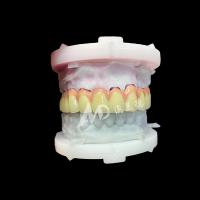 China Pure Titanium Ceramic Crown and Bridge Durable Lightweight Aesthetic Restorations for sale