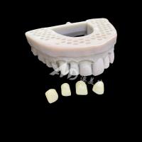 China IPS Emax Veneers High Quality Porcelain Dental Veneers for Natural Smile for sale