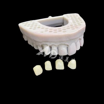 China IPS Emax Veneers High Quality Porcelain Dental Veneers for Natural Smile for sale
