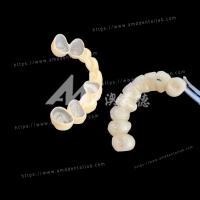 China Excellent Biocompatibility Porcelain Fused To Metal Crown Secure Bonding Natural Looking Aesthetic Durable Dental Crown for sale
