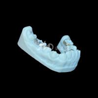 China Custom Lingual Arch with Bands Orthodontic Appliance for Space Maintenance and Dental Alignment for sale