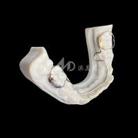 China Custom Lingual Arch with Bands Orthodontic Appliance for Space Maintenance and Dental Alignment for sale