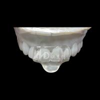 China Custom Mini Night Guard Orthodontic Appliance for Bruxism, Occlusal Protection and Comfortable Night Wear for sale
