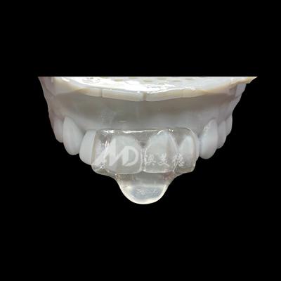China Custom Mini Night Guard Orthodontic Appliance for Bruxism, Occlusal Protection and Comfortable Night Wear for sale