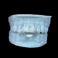 China Custom Mini Night Guard Orthodontic Appliance for Bruxism, Occlusal Protection and Comfortable Night Wear for sale