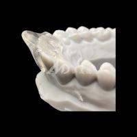 China Custom Mini Night Guard Orthodontic Appliance for Bruxism, Occlusal Protection and Comfortable Night Wear for sale