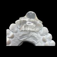 China Custom Mini Night Guard Orthodontic Appliance for Bruxism, Occlusal Protection and Comfortable Night Wear for sale