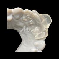 China Custom Mini Night Guard Orthodontic Appliance for Bruxism, Occlusal Protection and Comfortable Night Wear for sale