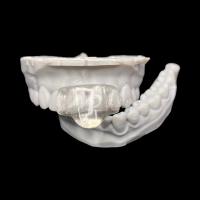 China Custom Mini Night Guard Orthodontic Appliance for Bruxism, Occlusal Protection and Comfortable Night Wear for sale