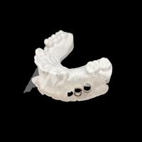 China Precise Fit 3D Printed Surgical Implant Guide with High Resistance to Discoloration Using CAD/CAM Milling Technology for sale