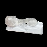 China Precise Fit 3D Printed Surgical Implant Guide with High Resistance to Discoloration Using CAD/CAM Milling Technology for sale