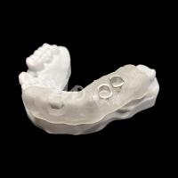 China Precise Fit 3D Printed Surgical Implant Guide with High Resistance to Discoloration Using CAD/CAM Milling Technology for sale