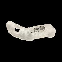 China Precise Fit 3D Printed Surgical Implant Guide with High Resistance to Discoloration Using CAD/CAM Milling Technology for sale