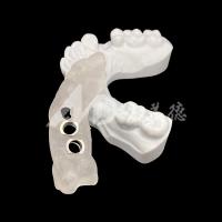 China Precise Fit 3D Printed Surgical Implant Guide with High Resistance to Discoloration Using CAD/CAM Milling Technology for sale