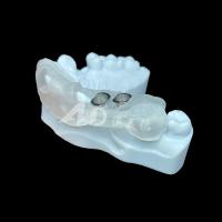 China Precise Fit 3D Printed Surgical Implant Guide with High Resistance to Discoloration Using CAD/CAM Milling Technology for sale