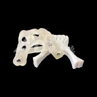China Digital Implant Surgical Guide with Implant Planning Report for sale