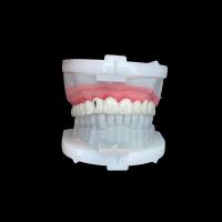 China Full Arch Implant Bridge with High-Strength CoCr Metal Framework and Premium Porcelain Layering for Precision Fit for sale