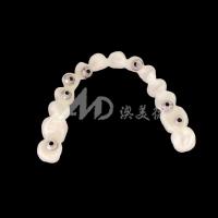 China Full Arch Implant Bridge with High-Strength CoCr Metal Framework and Premium Porcelain Layering for Precision Fit for sale