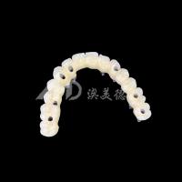 China Porcelain-Fused-to-Metal (PFM) Screw-Retained Implant Bridge for sale
